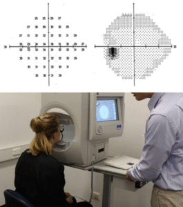 Campo Visual - Clínica Oftalmológica Cabecera